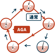 AGA治療薬 | AGA診療ガイドラインから推奨度別に治療薬を解説 | EPARKくすりの窓口